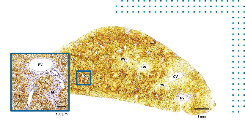 Humanized Liver Mouse Models for Translational Preclinical Research