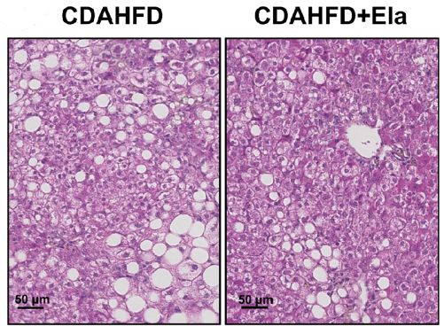 Targeting NASH Drug Development with a New Humanized Liver NASH Model