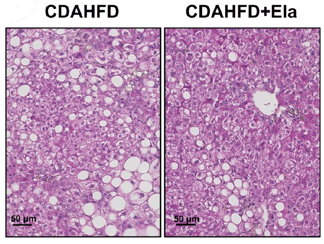 Targeting NASH Drug Development with a New Humanized Liver NASH Model
