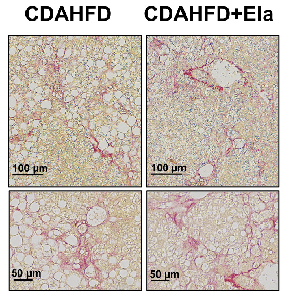 Targeting NASH Drug Development with a New Humanized Liver NASH Model