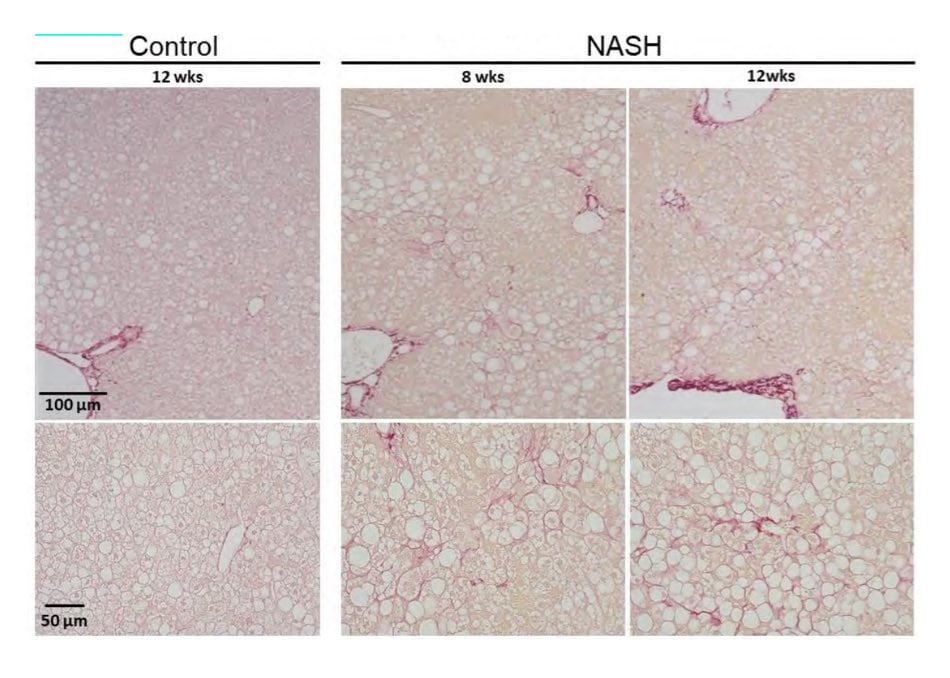 Humanized Liver MASH/MAFLD Model Applications
