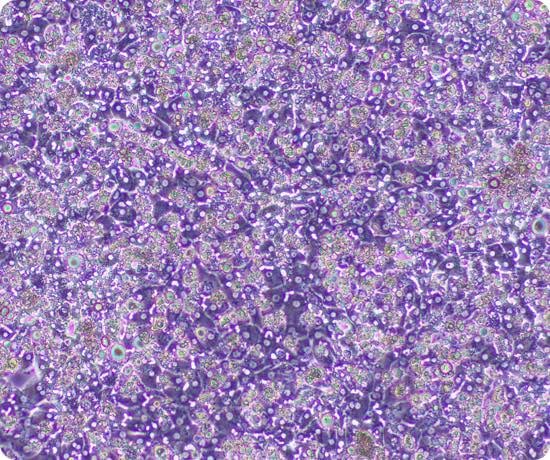 Translational mouse models: helping you to generate human-ready ...